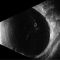On-platform, tabletop ultrasound system - ABSolu - Quantel Medical ...