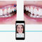 Digital smile design software - Smile Design - 3shape - dental ...