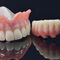 PEEK dental material - Pekkton® ivory - Cendres+Métaux SA - for dental ...