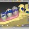 Dental laboratory software - inLab - DENTSPLY MAILLEFER - for dental ...