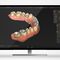 Dental laboratory software - inLab - DENTSPLY MAILLEFER - for dental ...