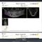 Clinical software - SICAT suite - DENTSPLY MAILLEFER - dental ...