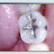 Intraoral camera - Ez SHOT Air - Good Doctors - digital / 1920 x 1080 ...