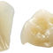 PMMA dental prosthesis - artVeneer® life - Merz Dental GmbH - anterior ...
