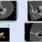 Surgery software - NNT - NewTom - dental / for dental imaging ...