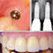 Cylindro-conical dental implant - Z1® Infinity - TBR Implants Group ...