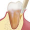 Xenograft bone substitute - 05GEL40E - Tecnoss Dental - for dental ...