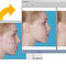Orthodontic software - OrthoVision™ - VATECH Networks - image analysis ...