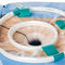 Extraction system - Alexis - Applied Medical