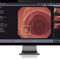 Medical software - Smart Endo - Infinitt Healthcare - image analysis ...