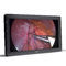 Endoscopy display - MDFC-8232 - Barco - surgical / 4K UHD / LCD