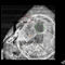 Radiosurgery QA system - ExacTrac® - Brainlab - radiation therapy ...