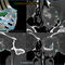 Navigation software - Brainlab - verification / medical / CT