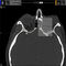 Medical software - Brainlab - CT / surgery / navigation