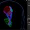 Medical software - Elements - Brainlab - neurosurgery / neurological ...