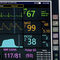Portable multi-parameter monitor - LifeWindow - Digicare Biomedical ...