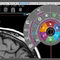 Medical imaging PACS - NovaPACS EI® - Novarad