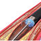 Atherectomy catheter - Turbo Elite - Spectranetics - peripheral