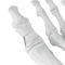 Foot phalange bone staple - DynafitSystem® - Neosteo - hallux valgus ...