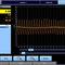 Catheterization laboratory software - SyncVision - Philips Volcano ...