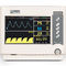 Portable multi-parameter monitor - Capnopleth - Nasan Medical ...