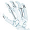 Metacarpal joint compression plate - LCP® - Depuy Synthes - locking ...