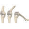 Three-compartment knee prosthesis - Unity ™ - Corin - sliding ...