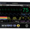 MRI patient monitor - 3885T - IRADIMED CORPORATION - portable / bedside ...