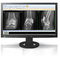 Diagnostic computer workstation - IDETEC MEDICAL IMAGING - radiology