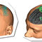 TMS neuronavigation system - Brainsight® - Brainbox