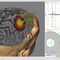 TMS neuronavigation system - Brainsight® - Brainbox