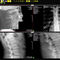 Medical imaging transmission system - Opal-RAD - 20/20 Imaging - for ...