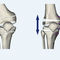 Epiphysis bone staple - PediatrOS™ FlexTack™ - Merete - non-absorbable ...