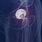 Revision hip prosthesis - BioBall® - Merete - primary / cemented or non ...