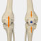 Epiphysis bone staple - PediatrOS™ RigidTack™ - Merete - non-absorbable ...