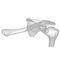 Clavicle compression bone screw - Dual-Trak - Acumed - headless / metallic