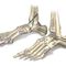 Calcaneus compression bone screw - Acutrak 2 - Acumed - hand / headless ...