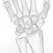 Small bone fragment bone staple - InstaFix™ - Acumed - non-absorbable