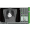 Radiography acquisition system - iRay DR - iRay Technology - portable
