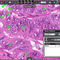 Viewer software - SlideViewer - 3DHISTECH Ltd. - for digital ...