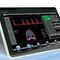 Intensive care ventilator - Bellavista 1000e - ERTUNÇ ÖZCAN ...