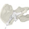 Hip prosthesis resection guide - MyPAO® - Medacta