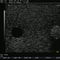 Ultrasound imaging test phantom - 054GS - CIRS - general purpose