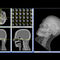 CT scan test phantom - 711-HN - CIRS - head