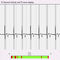 Heart rate variability analysis software - Actiheart 5 - CamNtech ...