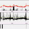Heart rate variability analysis software - Actiheart 5 - CamNtech ...
