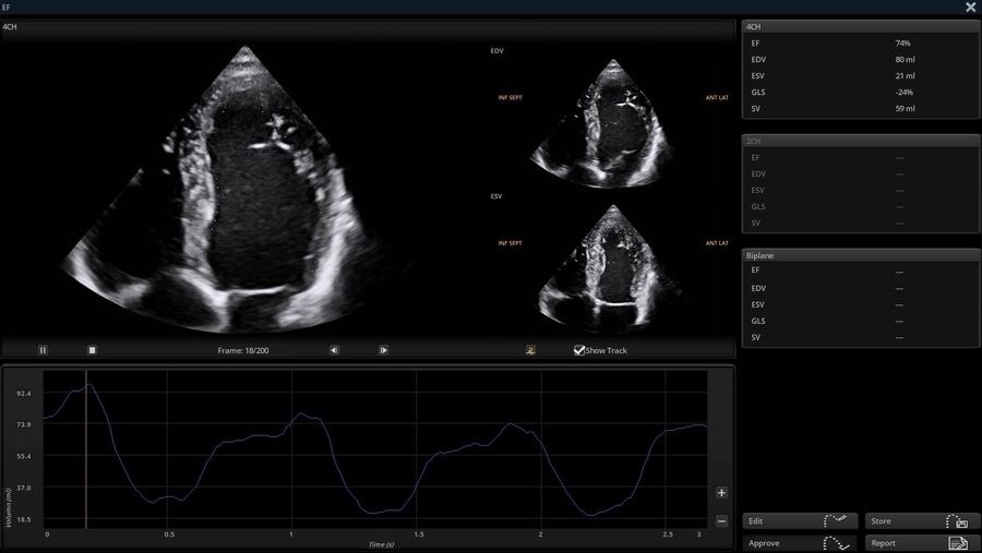 SIUI Introduces Apogee 6500 - Shantou, Guangdong Province, China - SIUI