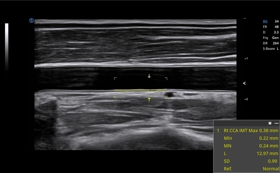 SIUI Introduces Apogee 6500 - Shantou, Guangdong Province, China - SIUI