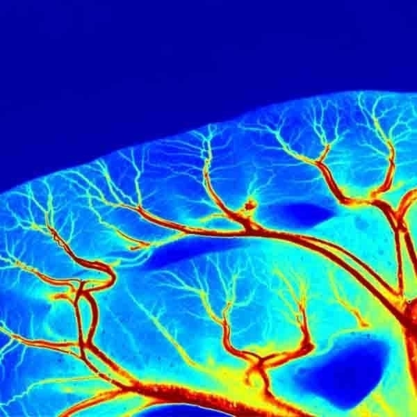 Detailed Introduction of RFLSI ZW Laser Speckle Contrast Imaging System ...