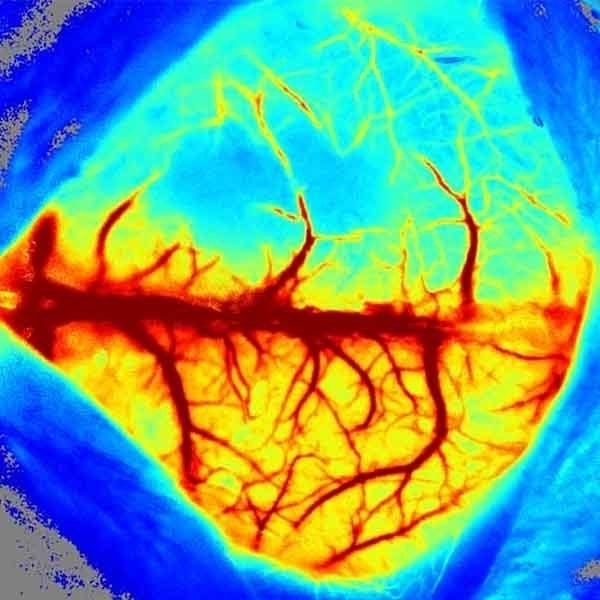Detailed Introduction of RFLSI ZW Laser Speckle Contrast Imaging System ...